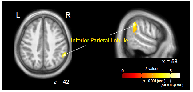 Research group identifies the parts of the brain that can distinguish a ...